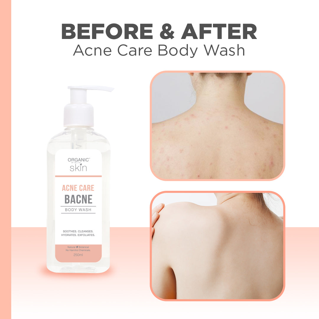 Organic Skin Japan Acne Care Bacne Body Wash 250ml